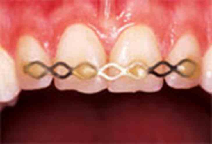 Titanium Trauma Splint 52x0,2mm von Medartis im Preisvergleich - AERA ...